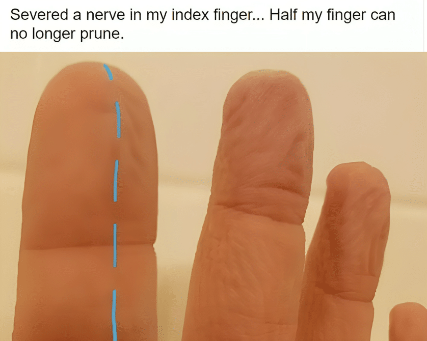 People Share Their Most Intriguing Body Abnormalities – Page 45